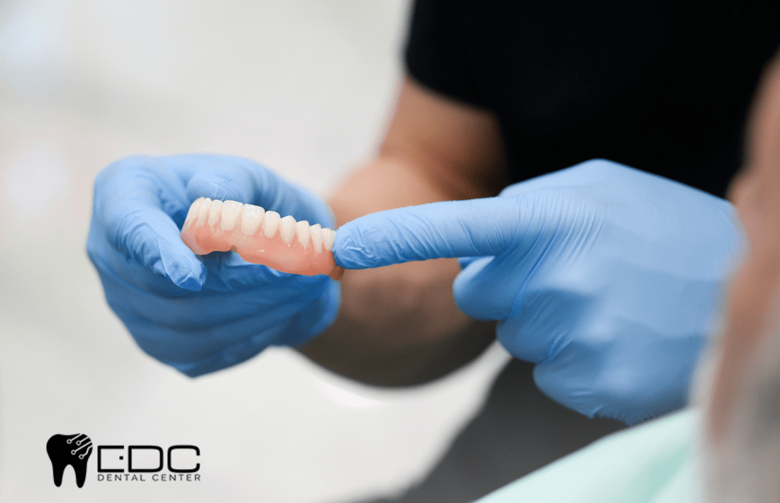 ¿Cómo cuidar de mi Prótesis Dental? | Esthetic Dental Center